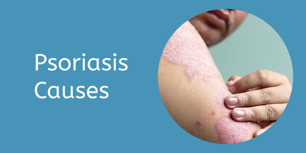 Psoriasis Causes Ayurvedic Psoriasis Treatment